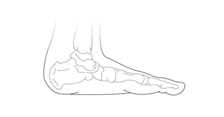 When Toe Pain Turns Serious: Signs Surgery Might Be Necessary