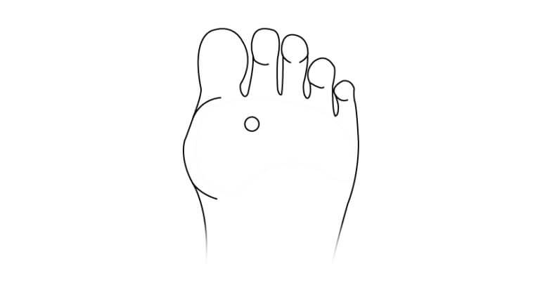 Common Types of Toe Surgeries: What You Need to Know