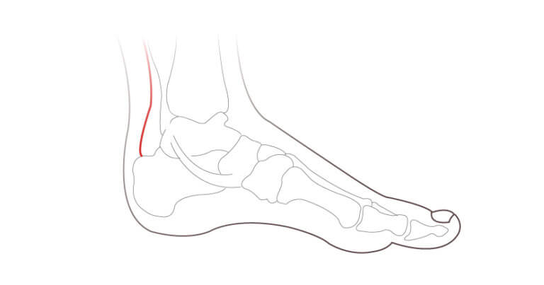 Common Types of Toe Surgeries: What You Need to Know