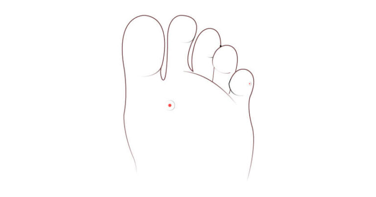 Common Types of Toe Surgeries: What You Need to Know
